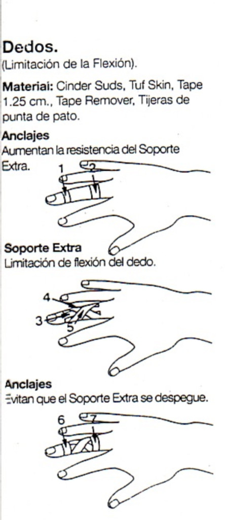 Ortopedia 25 Capsulitis: la lesión de los deportistas con balón